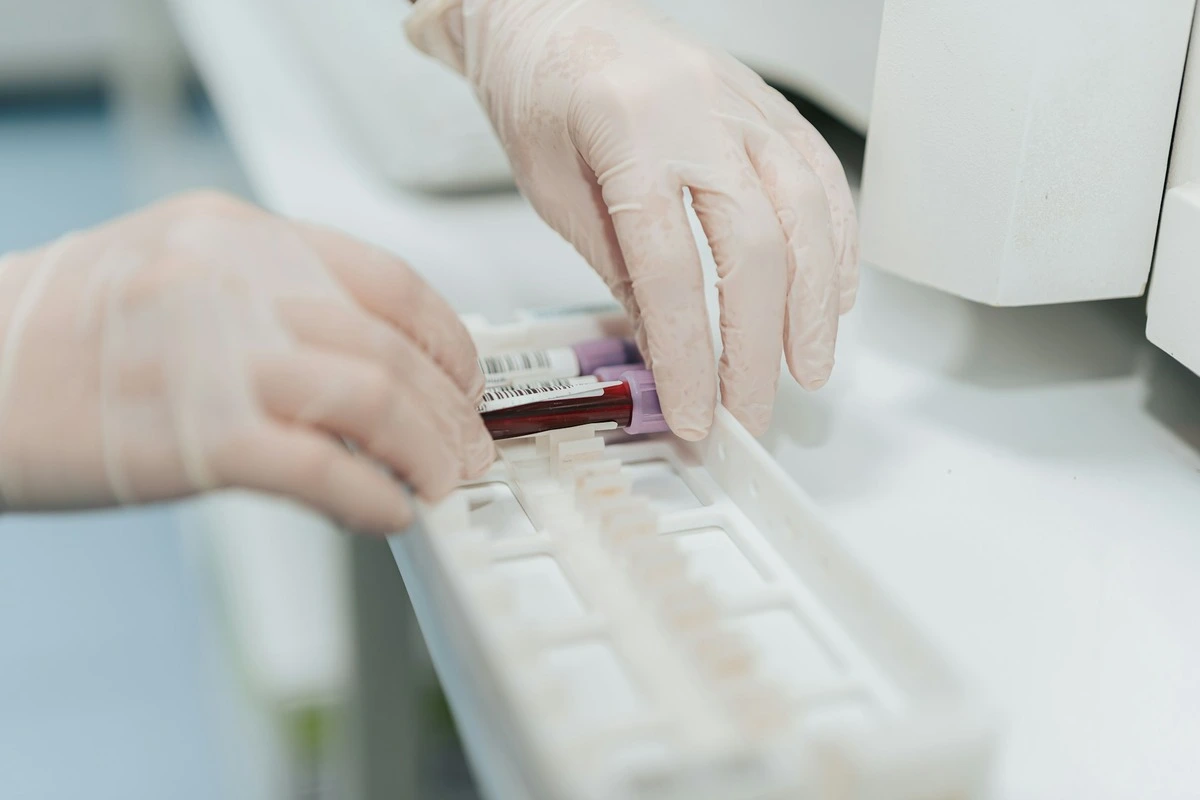Cystatin C Test: Normal Range, High Levels and Why It Matters