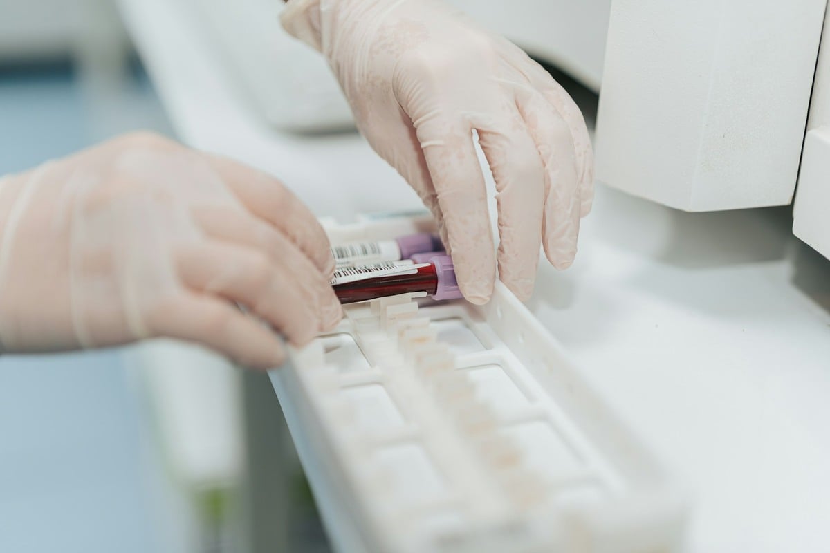 Total Antioxidant Capacity (TAC) Test: What Does it Measure?